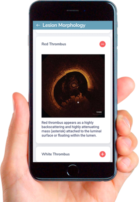 OCTAID Home - Cardiology Apps