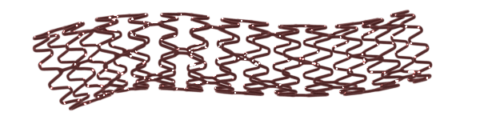 Stent Diameter Sizing - Cardiology Apps