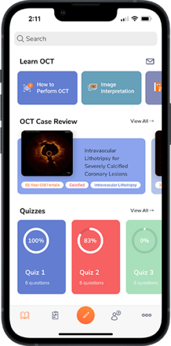 Ostial flash balloon - Cardiology Apps