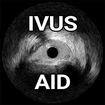 IVUSAID Key Concepts - Cardiology Apps