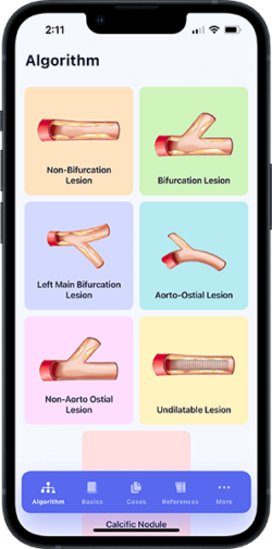 Ostial flash balloon - Cardiology Apps
