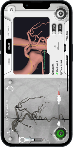 Basics - Vascular Access - Cardiology Apps